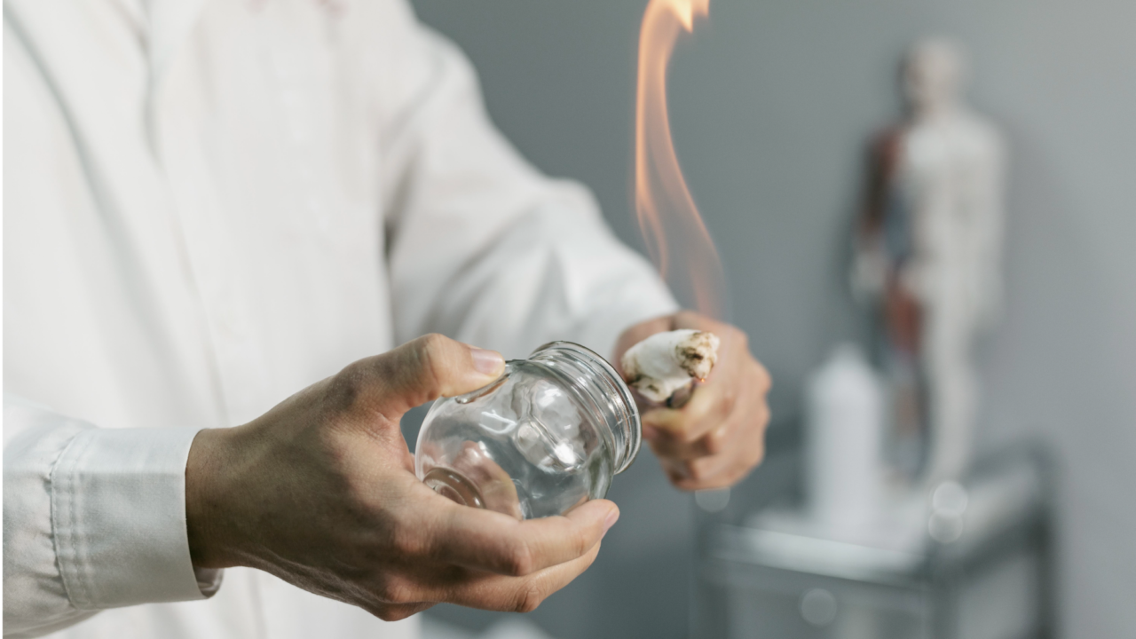 Traditional Fire Cupping - Seraphim Health and Wellness