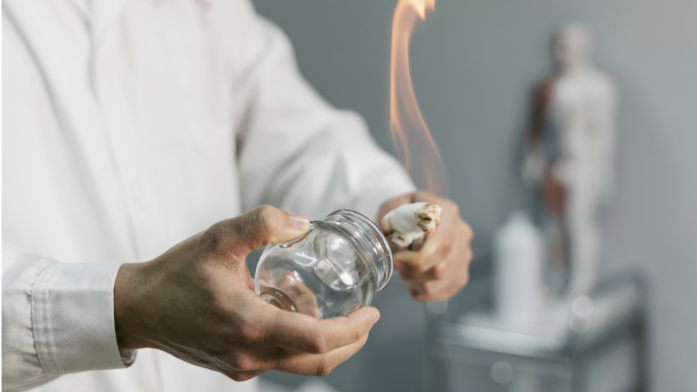 Traditional Fire Cupping - Seraphim Health and Wellness